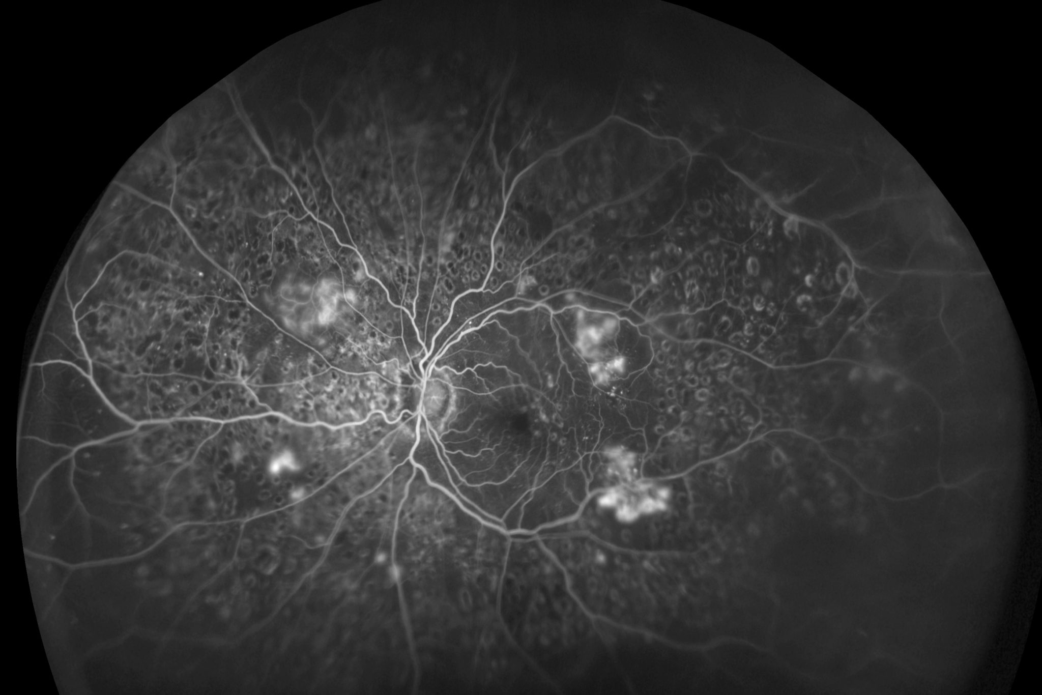 Why Optomap? - Dr. Scott & Associates